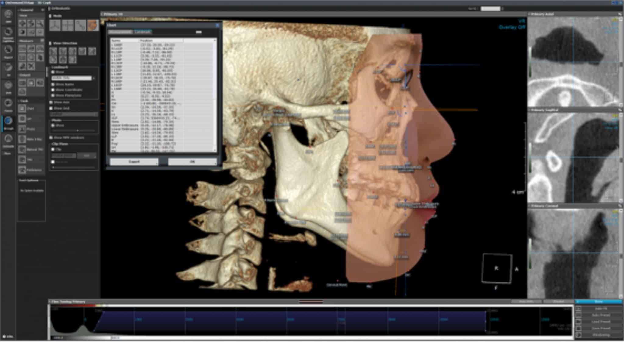 OnDemand 3D Full Application + Ceph Module - DigiRay