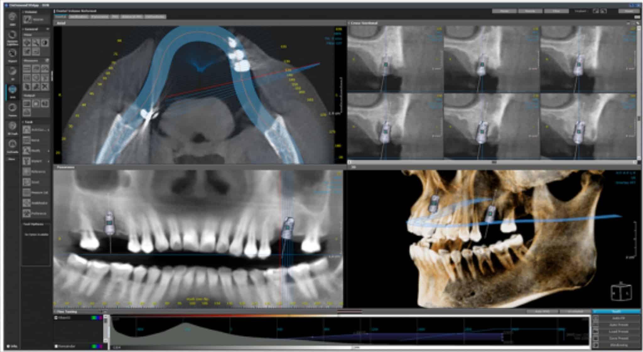 OnDemand 3D Full Application - DigiRay