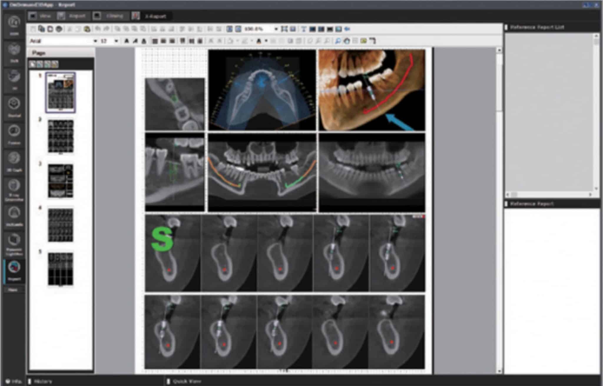 OnDemand 3D Full Application - DigiRay