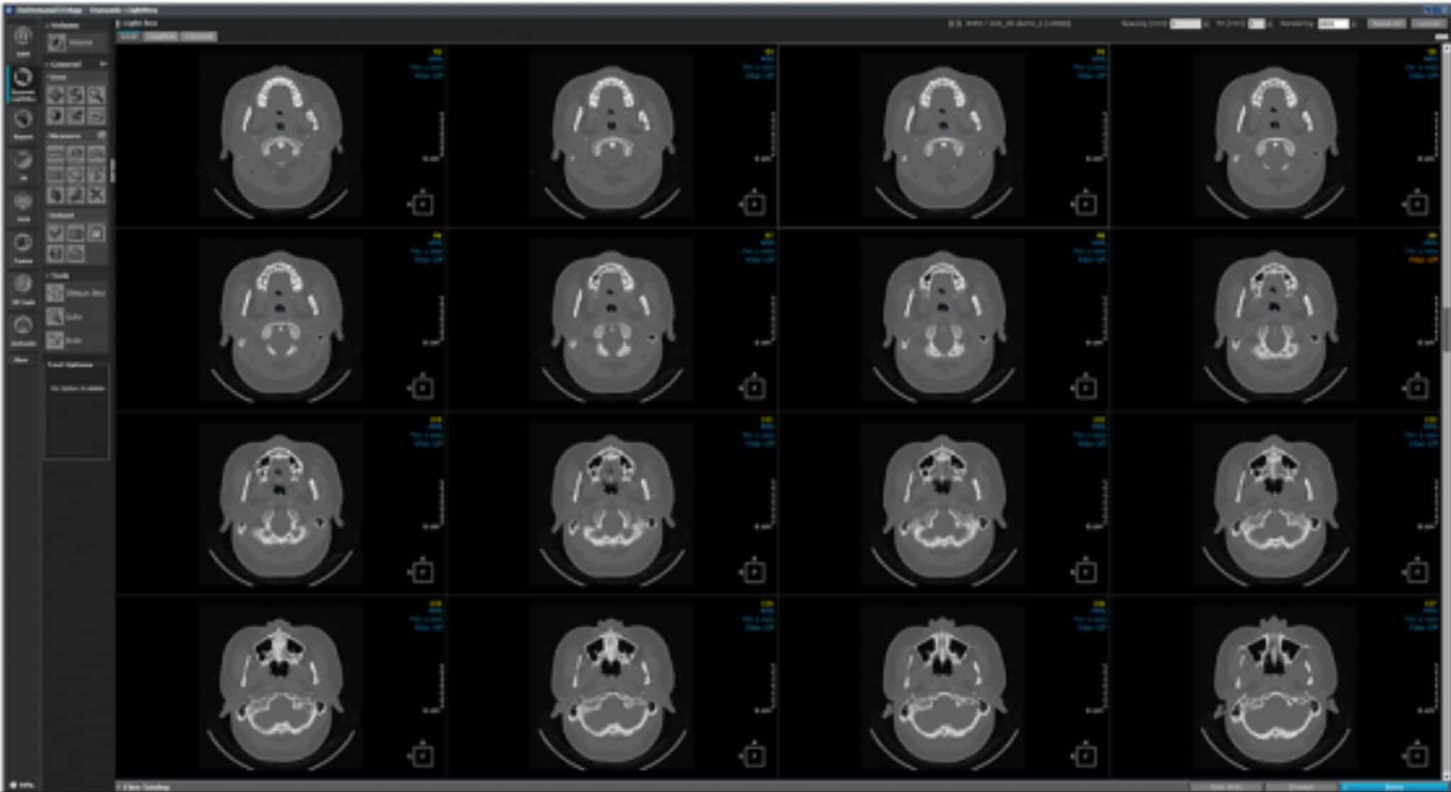 OnDemand 3D Full Application - DigiRay