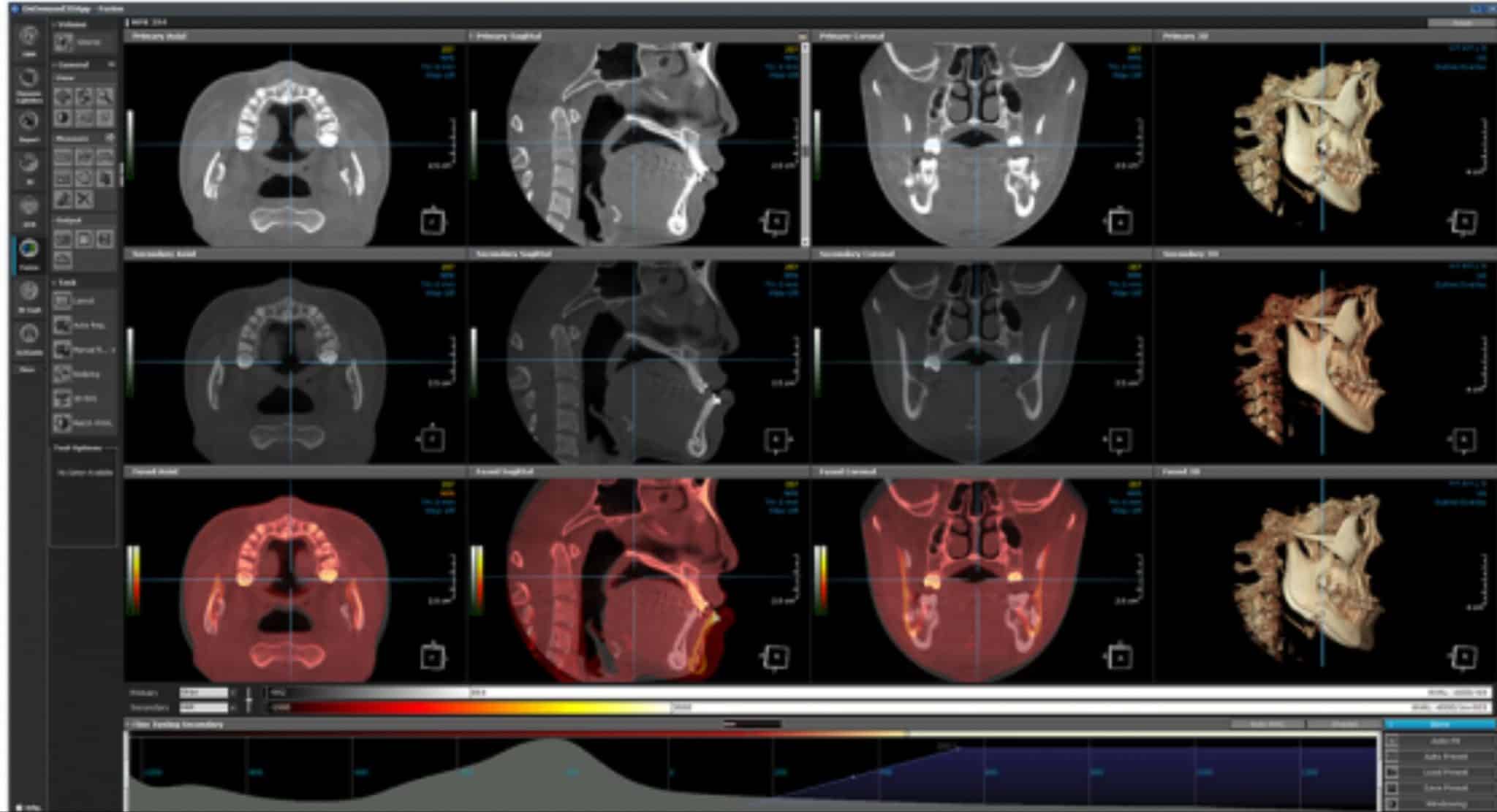 OnDemand 3D Full Application - DigiRay