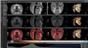 OnDemand 3D Full Application - DigiRay