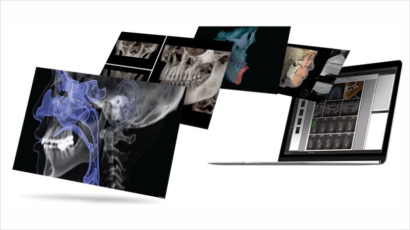 OnDemand 3D Project Viewer - DigiRay