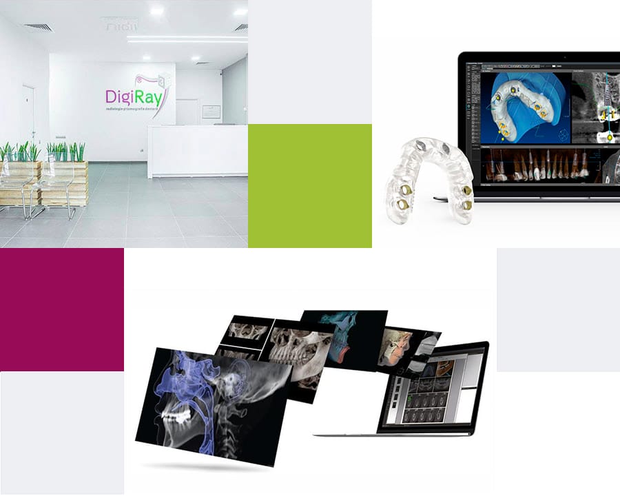 DigiRay - Rețea de imagistică maxilo-facială și tehnică dentară
