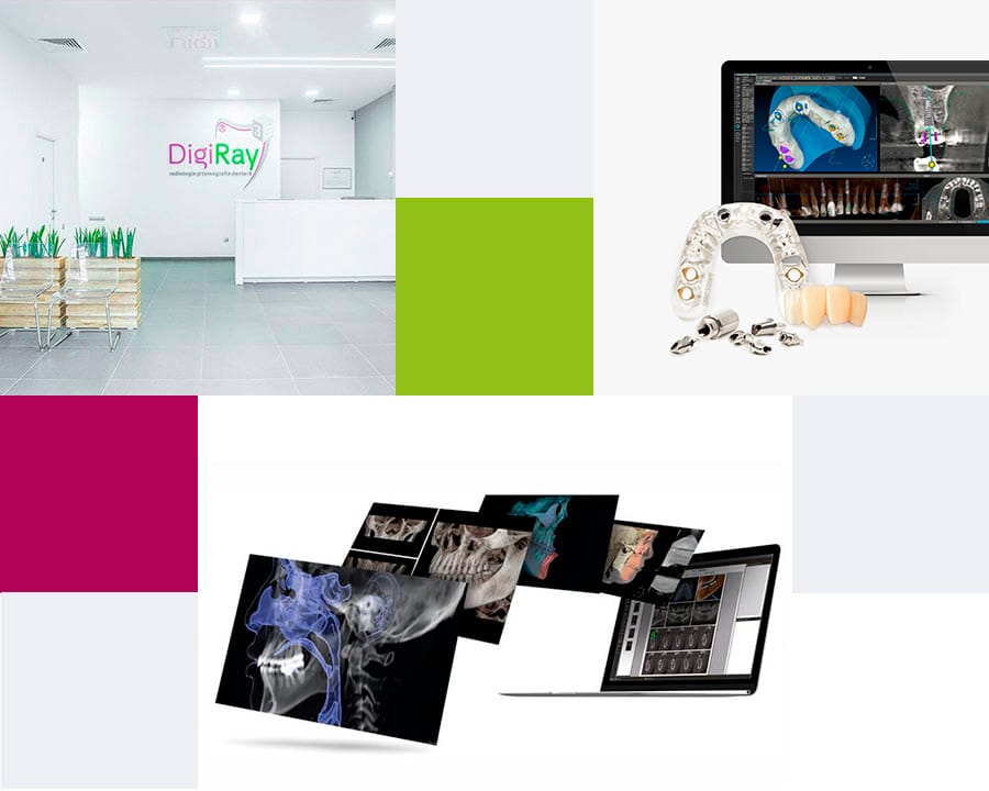 Cluj-Napoca - DigiRay - Cea mai mare rețea de radiologie dentară