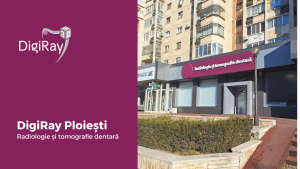 DigiRay - Cea mai mare rețea de radiologie dentară din România