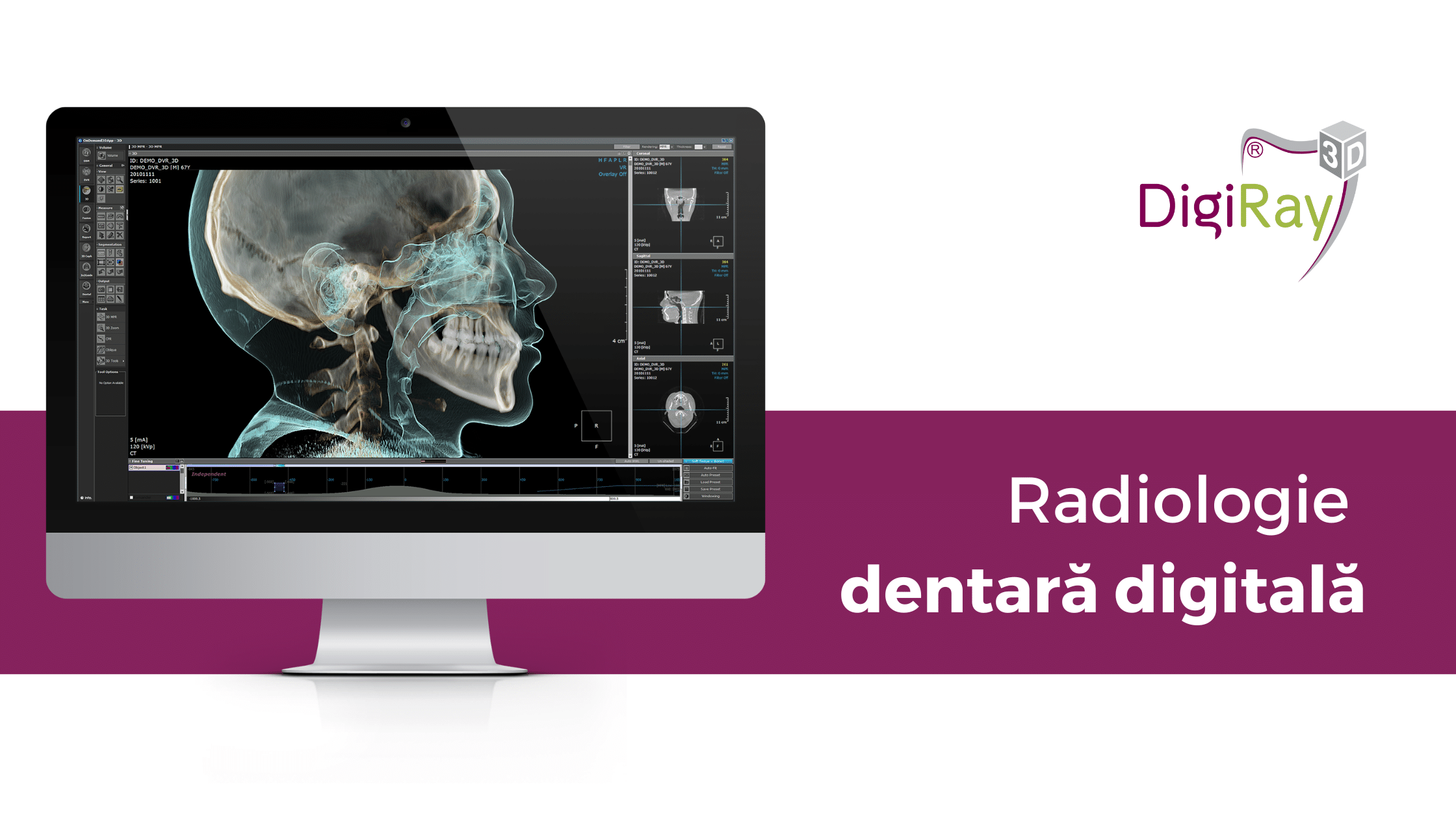 Centrele DigiRay: radiologie dentară digitală precisă și rapidă - DigiRay